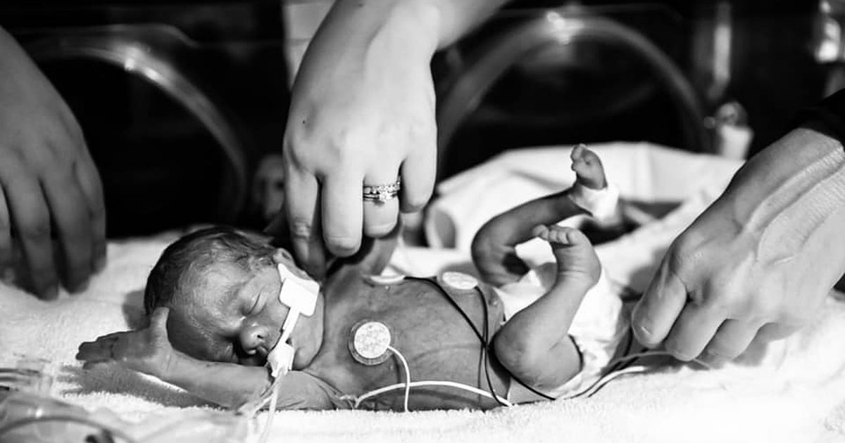 This micro-preemie beating the odds is a true Christmas miracle ...